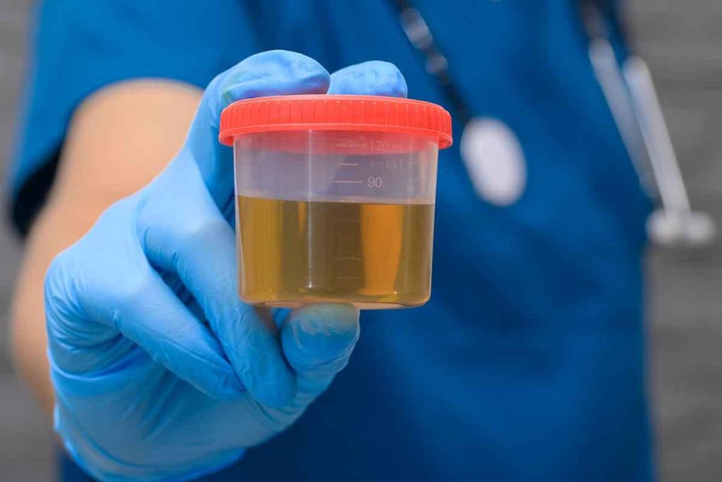 Fahamu Tofauti Kati ya UTI na Malaria Unazopaswa Kuzijua - Global ...